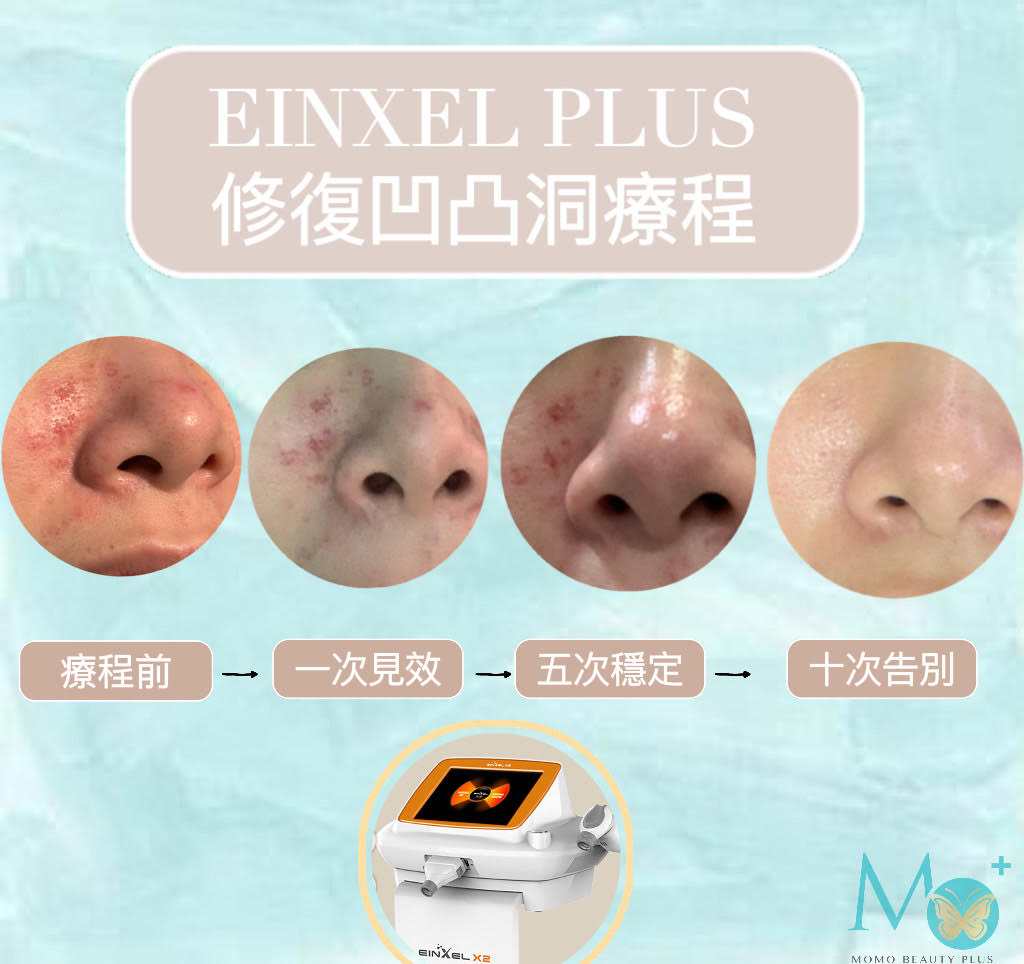 Einxel Plus 毛孔凹凸洞女神槍